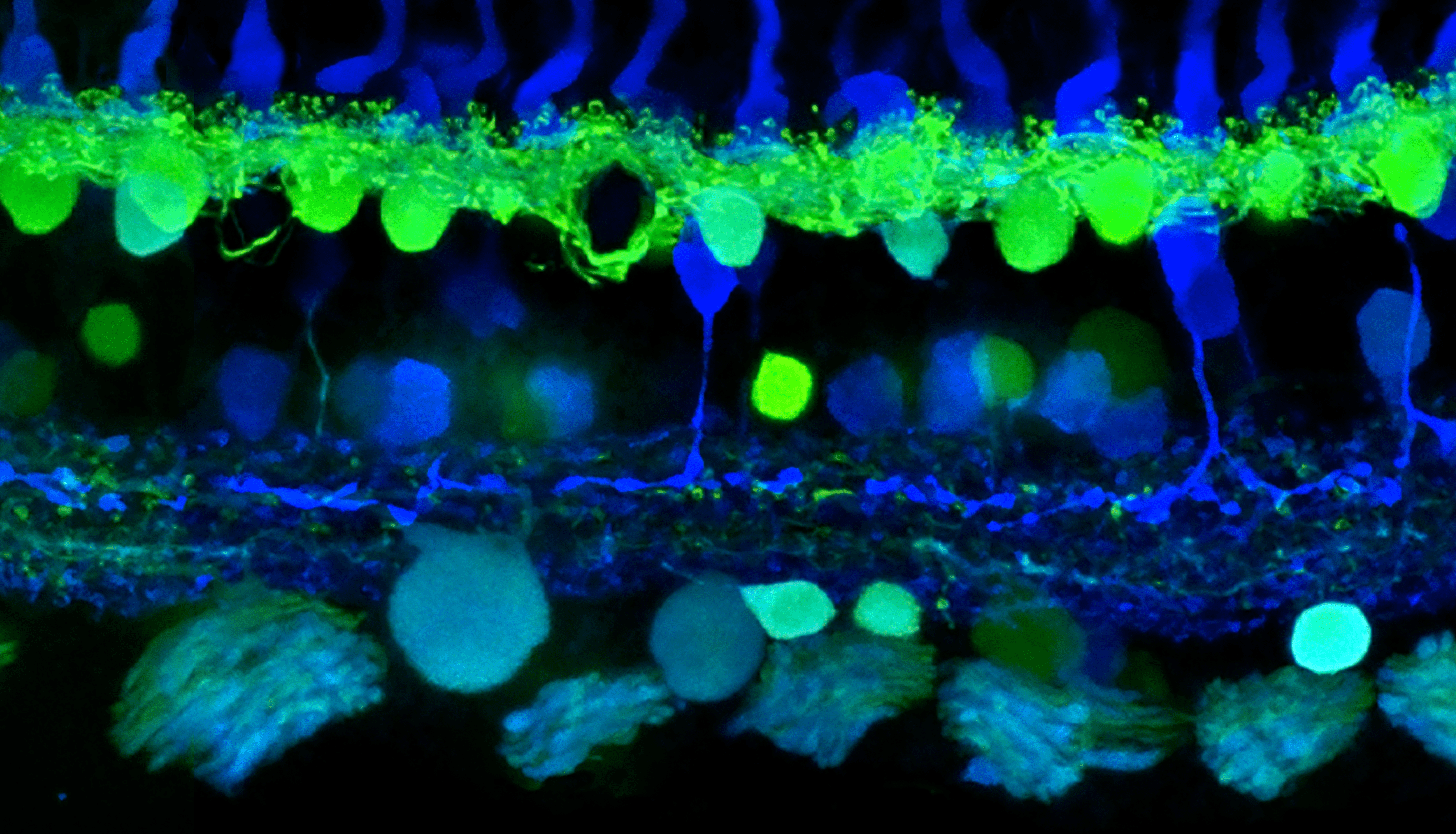 Horizontal cells – Retinal Microscopy